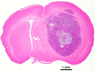 Combination Radiotherapy in an Orthotopic Mouse Brain Tumor Model ...