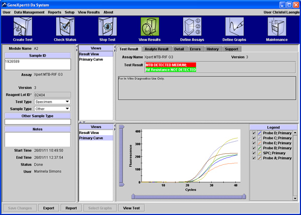 Diagnosing Pulmonary Tuberculosis with the Xpert MTB/RIF Test | Protocol