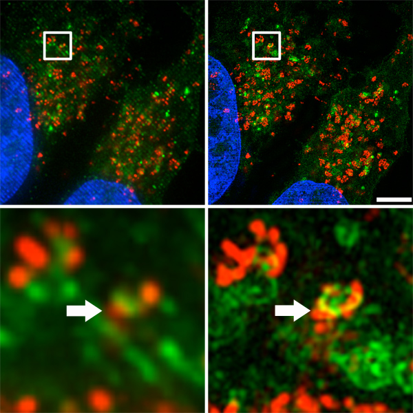 Quantitative Analysis of Autophagy using Advanced 3D Fluorescence ...
