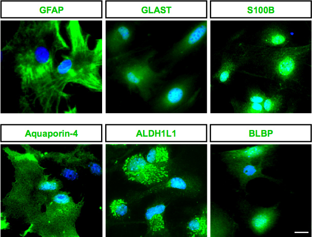 Isolation and Culture of Mouse Cortical Astrocytes | Protocol