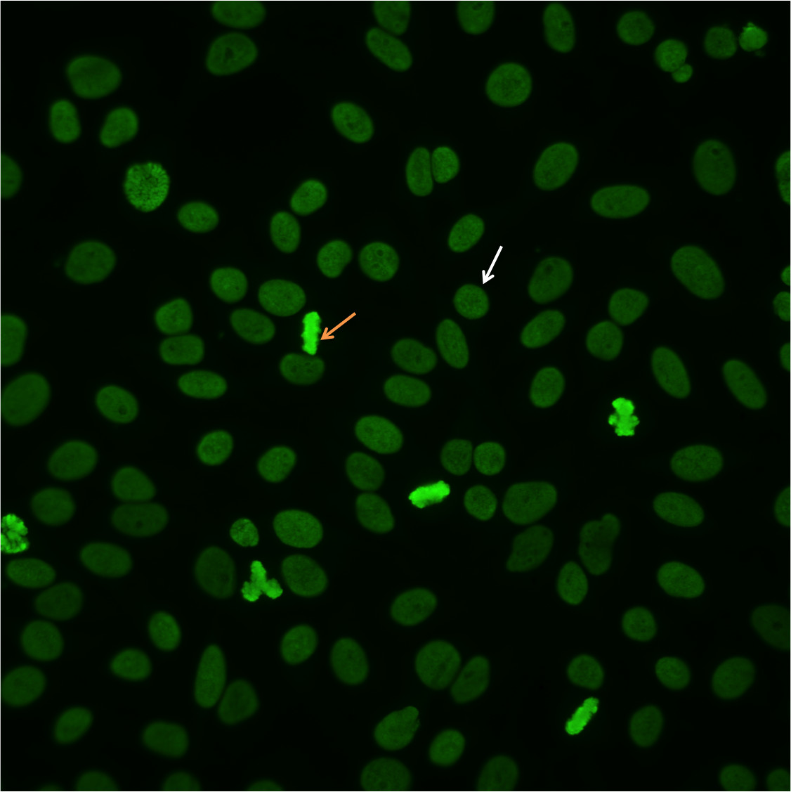 Anti-Nuclear Antibody Screening Using HEp-2 Cells | Protocol ...