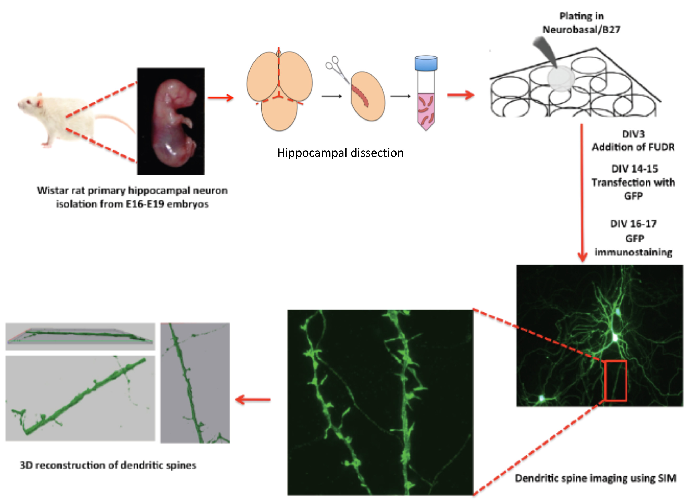 Imaging Dendritic Spines of Rat Primary Hippocampal Neurons using Structured Illumination ...