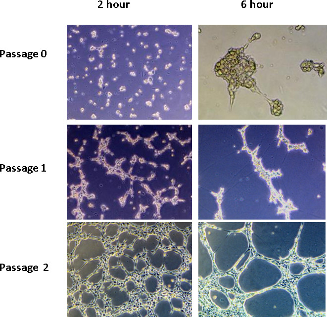 Endothelial Cell Tube Formation Assay for the In Vitro Study of ...