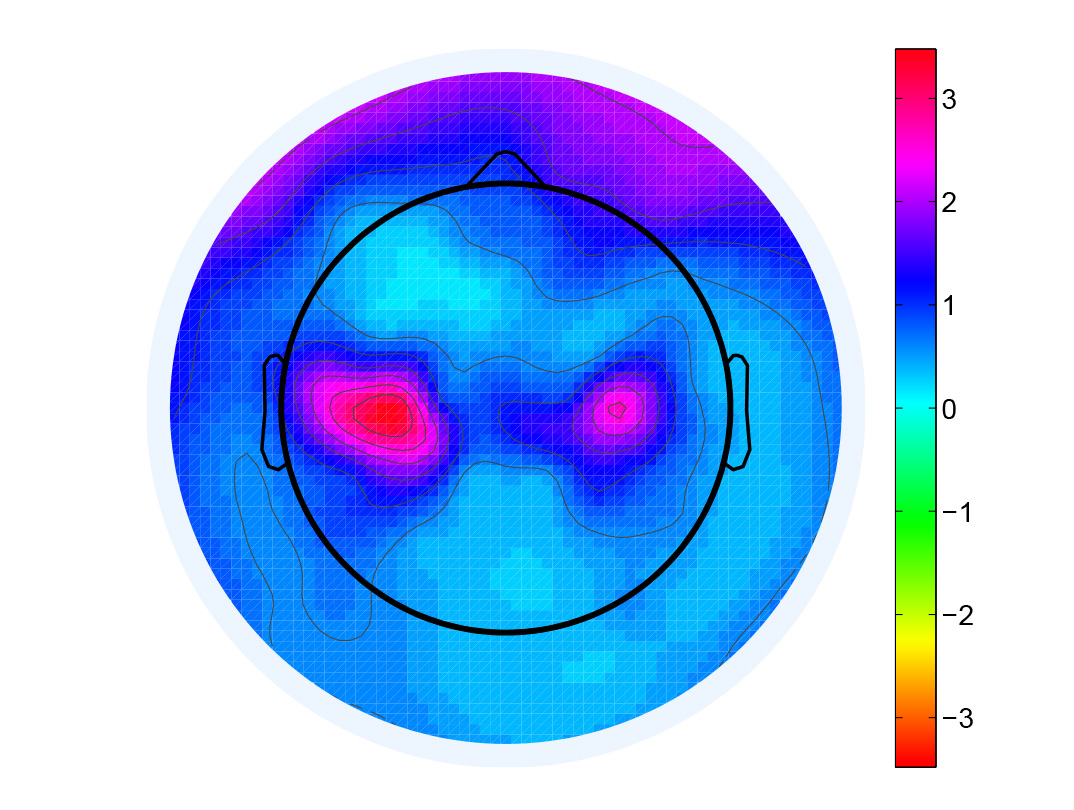 EEG Mu Rhythm in Typical and Atypical Development | Protocol