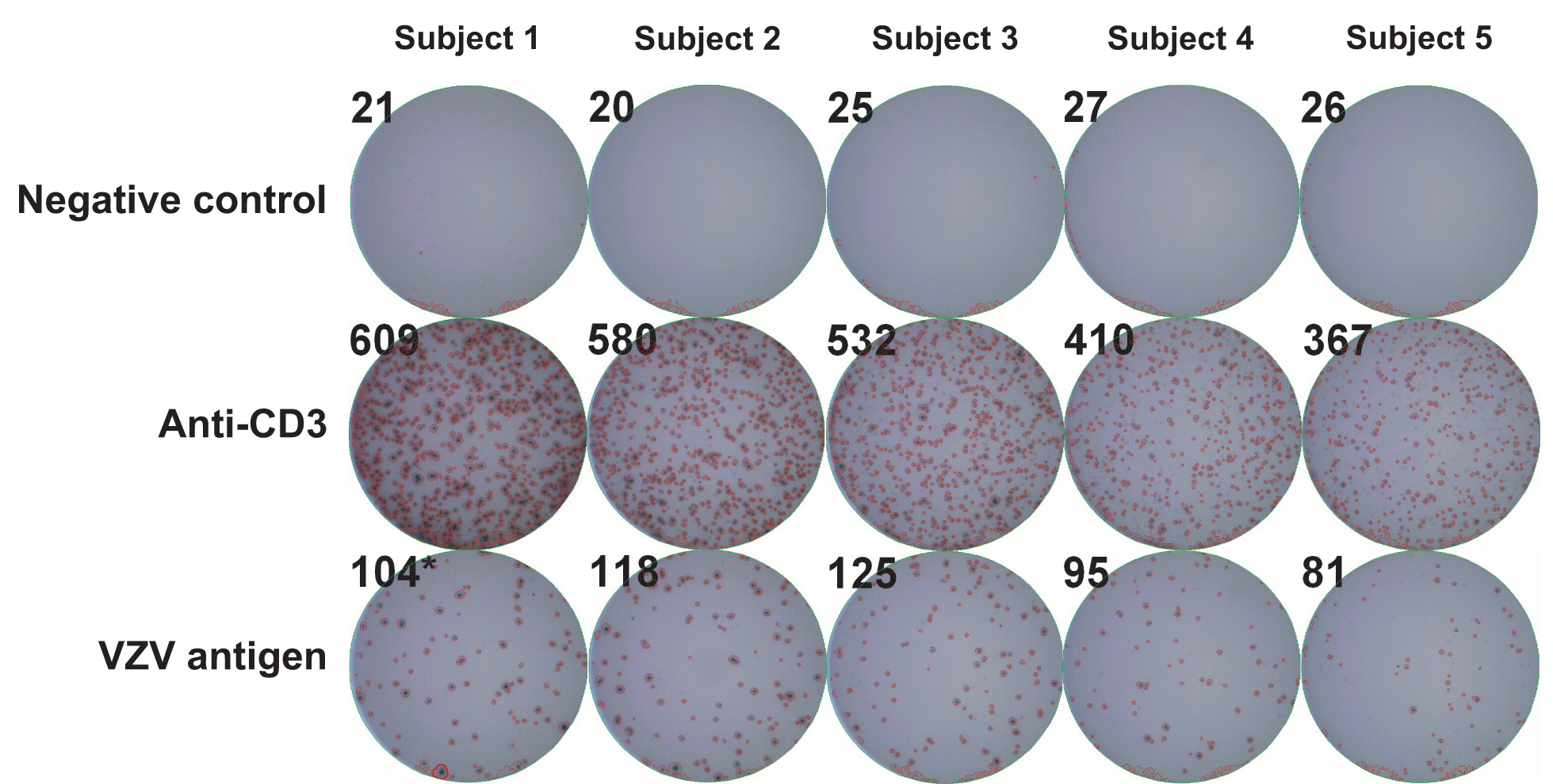 Development of an IFN-γ ELISpot Assay to Assess Varicella-Zoster Virus-specific Cell-mediated ...