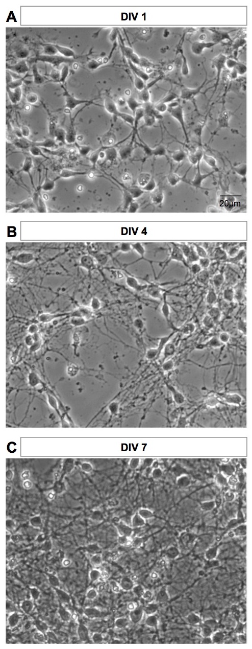 Primary Culture of Mouse Dopaminergic Neurons | Protocol