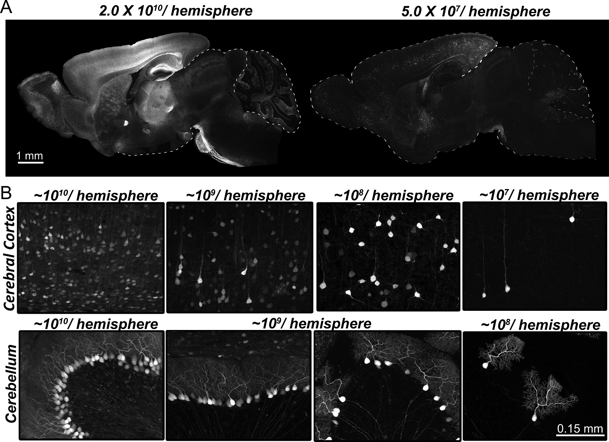 Intracerebroventricular Viral Injection of the Neonatal Mouse Brain for ...