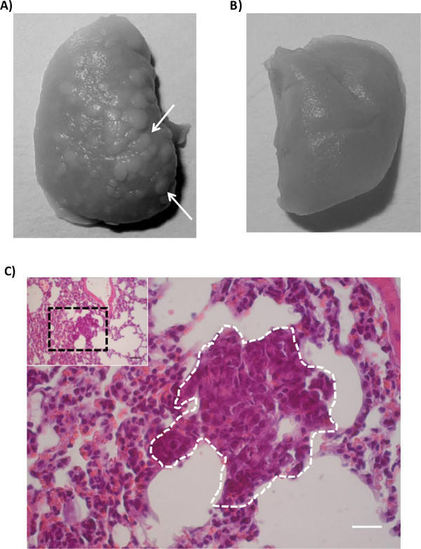 Orthotopic Injection of Breast Cancer Cells into the Mammary Fat Pad of ...