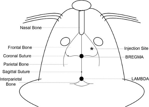 Creating Anatomically Accurate and Reproducible Intracranial Xenografts ...