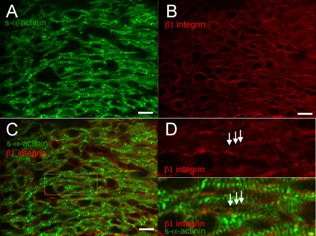 Analysis of Cardiomyocyte Development using Immunofluorescence in ...