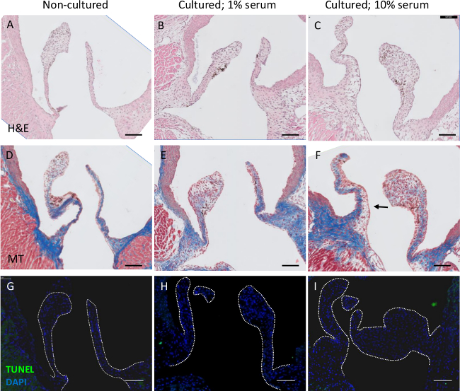 Culturing Mouse Cardiac Valves in the Miniature Tissue Culture System ...