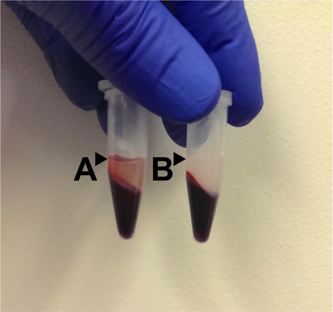 Sampling Blood from the Lateral Tail Vein of the Rat | Protocol
