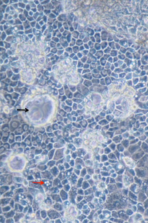 Using Caco-2 Cells to Study Lipid Transport by the Intestine | Protocol