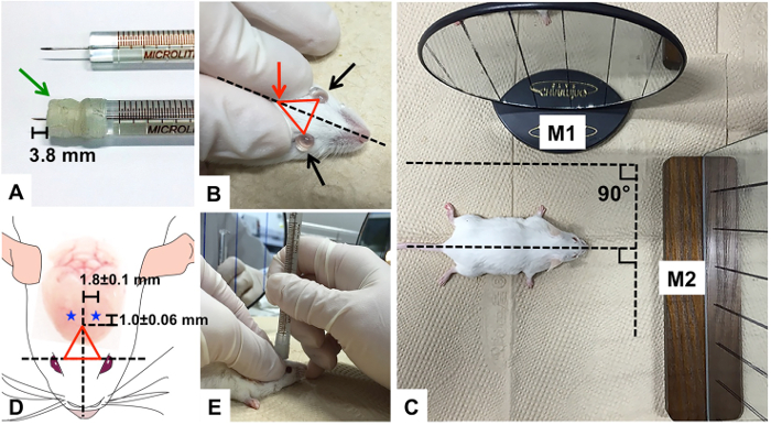 Intracerebroventricular Injection of Amyloid-β Peptides in Normal Mice ...