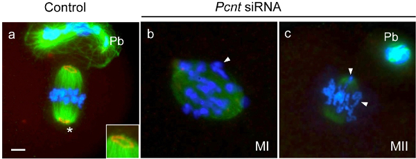 Meiotic Spindle