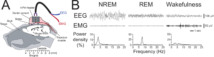 Polygraphic Recording Procedure for Measuring Sleep in Mice | Protocol