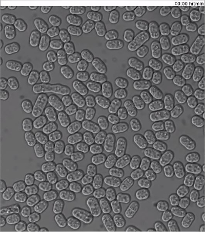 Hemocytometer For Blood Cell Sperm Bacteria Yeast