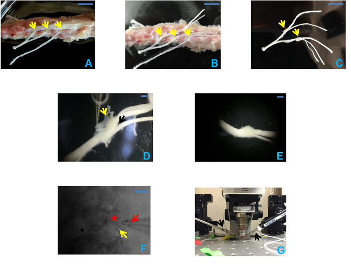 Patch Clamp Recordings on Intact Dorsal Root Ganglia from Adult Rats ...