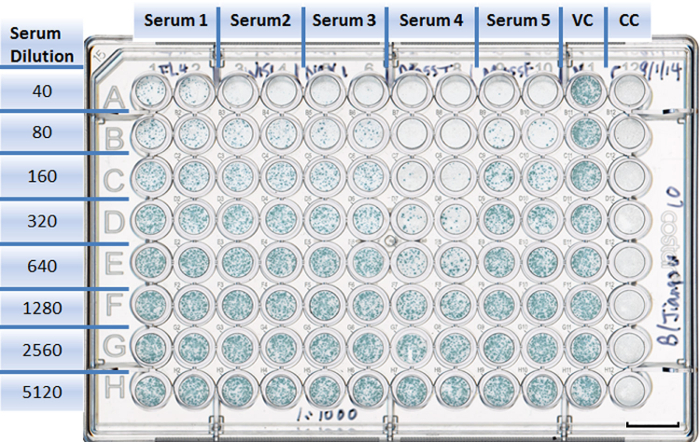 Neutralisationstest SARS CoV 2 Serology Assays | Thermo Fisher