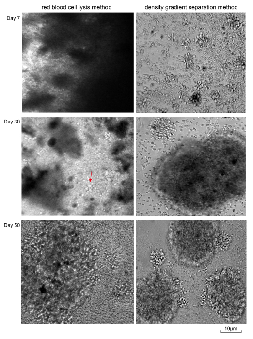 Red Cell Lysis Buffer Recipe | Besto Blog