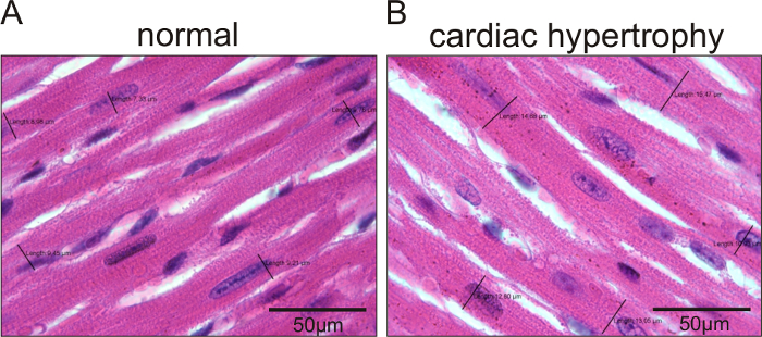 Echocardiographic and Histological Examination of Cardiac Morphology in ...