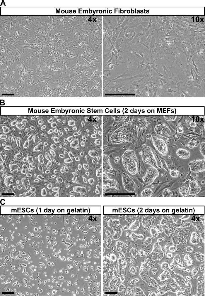 Differentiation of Mouse Embryonic Stem Cells into Cortical Interneuron ...
