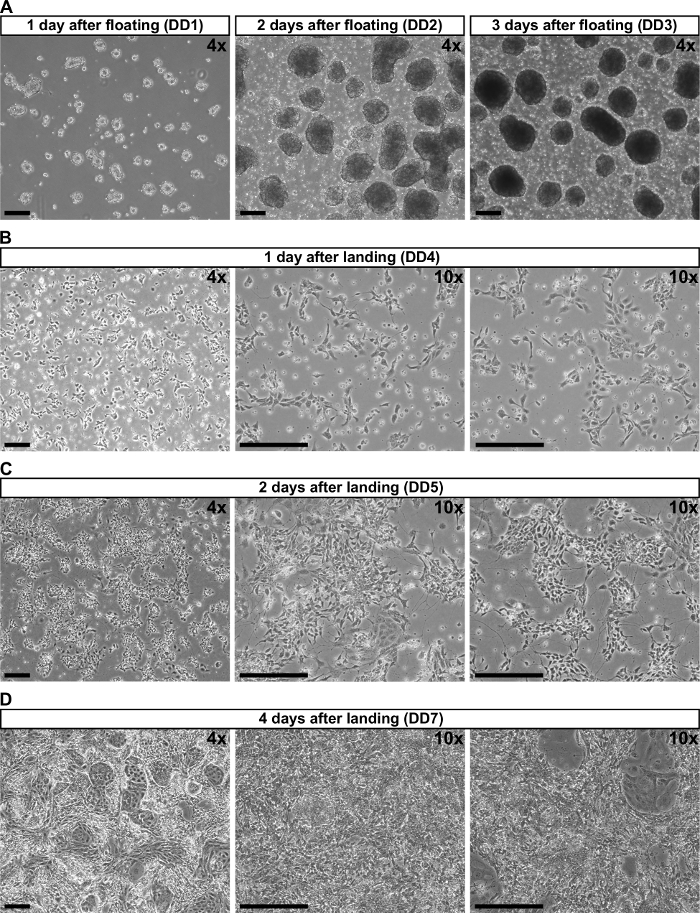 Differentiation of Mouse Embryonic Stem Cells into Cortical Interneuron ...