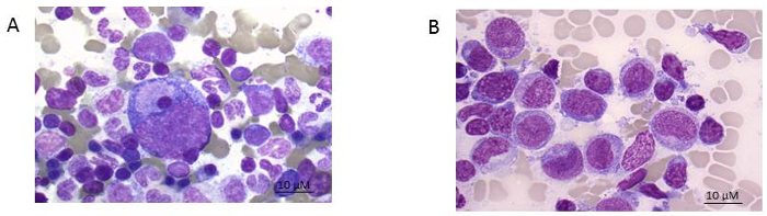 😀 Normal bone marrow smear. Bone marrow. 2019-03-05
