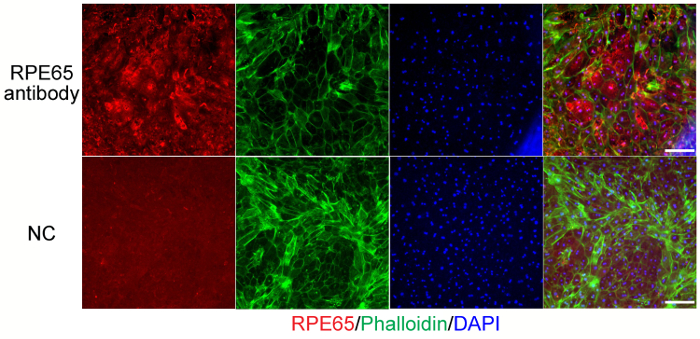 Primary Cell Cultures from the Mouse Retinal Pigment Epithelium | Protocol