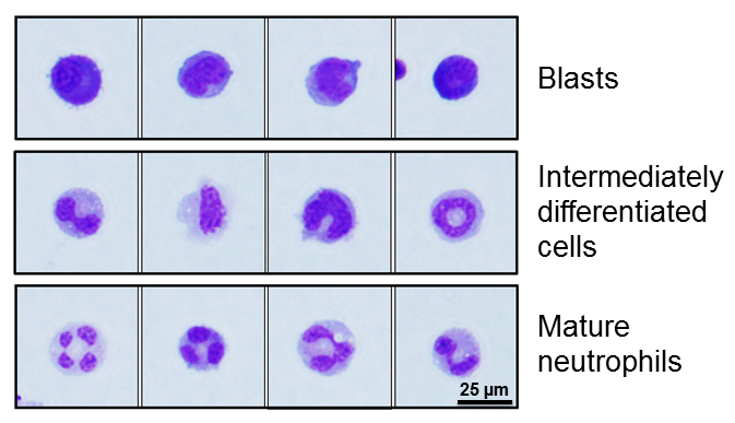 Proliferation and Differentiation of Murine Myeloid Precursor 32D/G-CSF ...