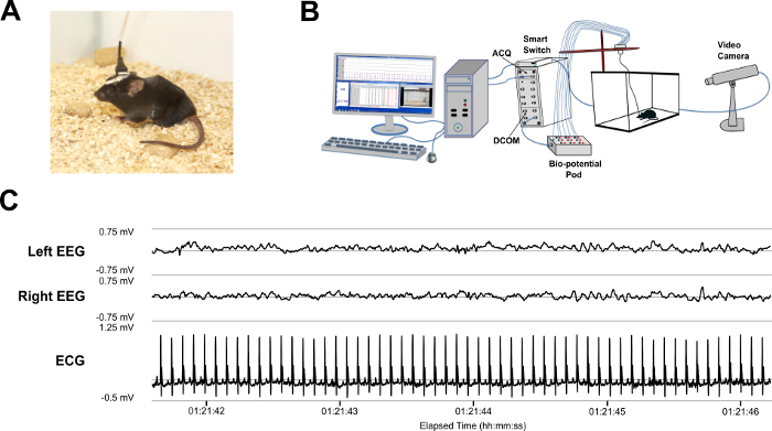 Simultaneous Video-EEG-ECG Monitoring to Identify Neurocardiac Dysfunction in Mouse Models of ...