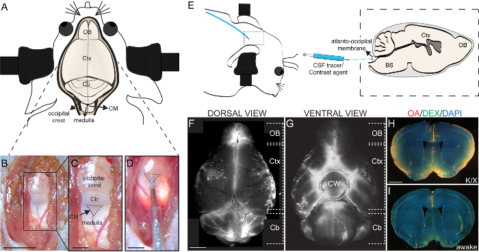 Cannula Implantation into the Cisterna Magna of Rodents | Protocol