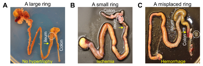 A Mouse Model of Intestinal Partial Obstruction | Protocol