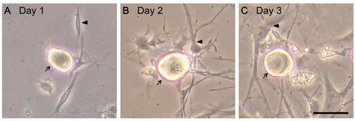Dorsal Root Ganglia Isolation and Primary Culture to Study ...