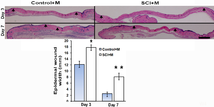 Mouse Model of Pressure Ulcers After Spinal Cord Injury | Protocol
