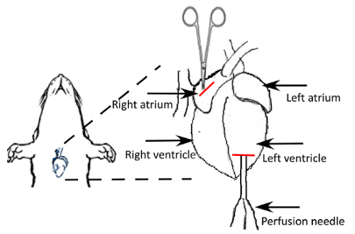 Listeria monocytogenes Infection of the Brain | Protocol