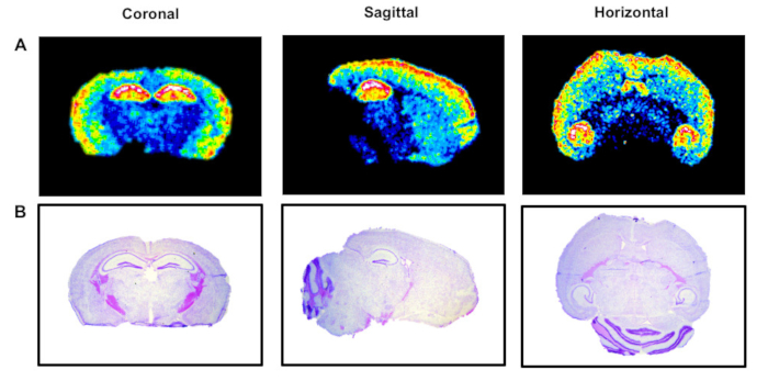 Autoradiography as a Simple and Powerful Method for Visualization and ...